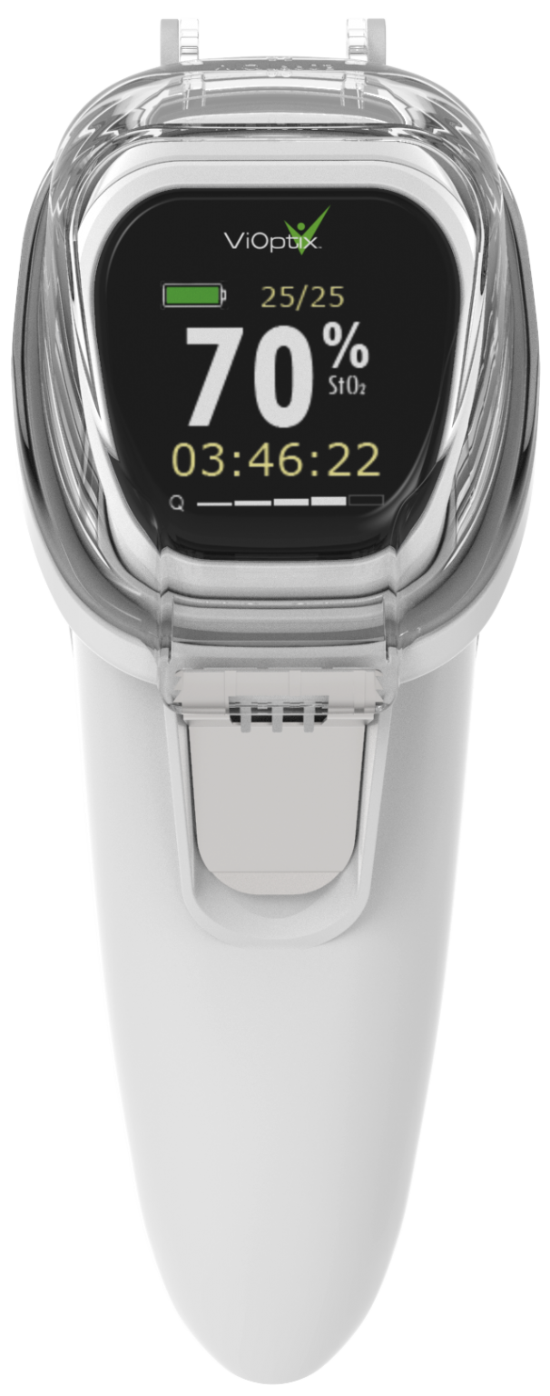 intraox-front - Vioptix